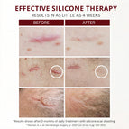 HealFast Silicone Scar Gel & Cream for Surgical Scars - Medical Grade ...